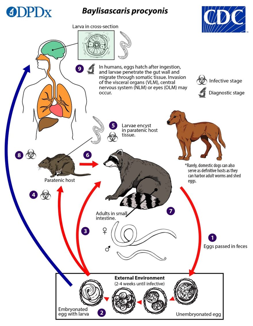 Raccoon Roundworm (Baylisascaris procyonis) Infections in People ...