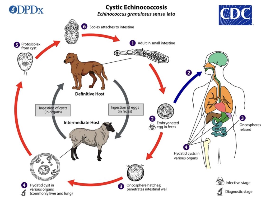 Infection control for alveolar echinococcosis (non-gastrointestinal ...